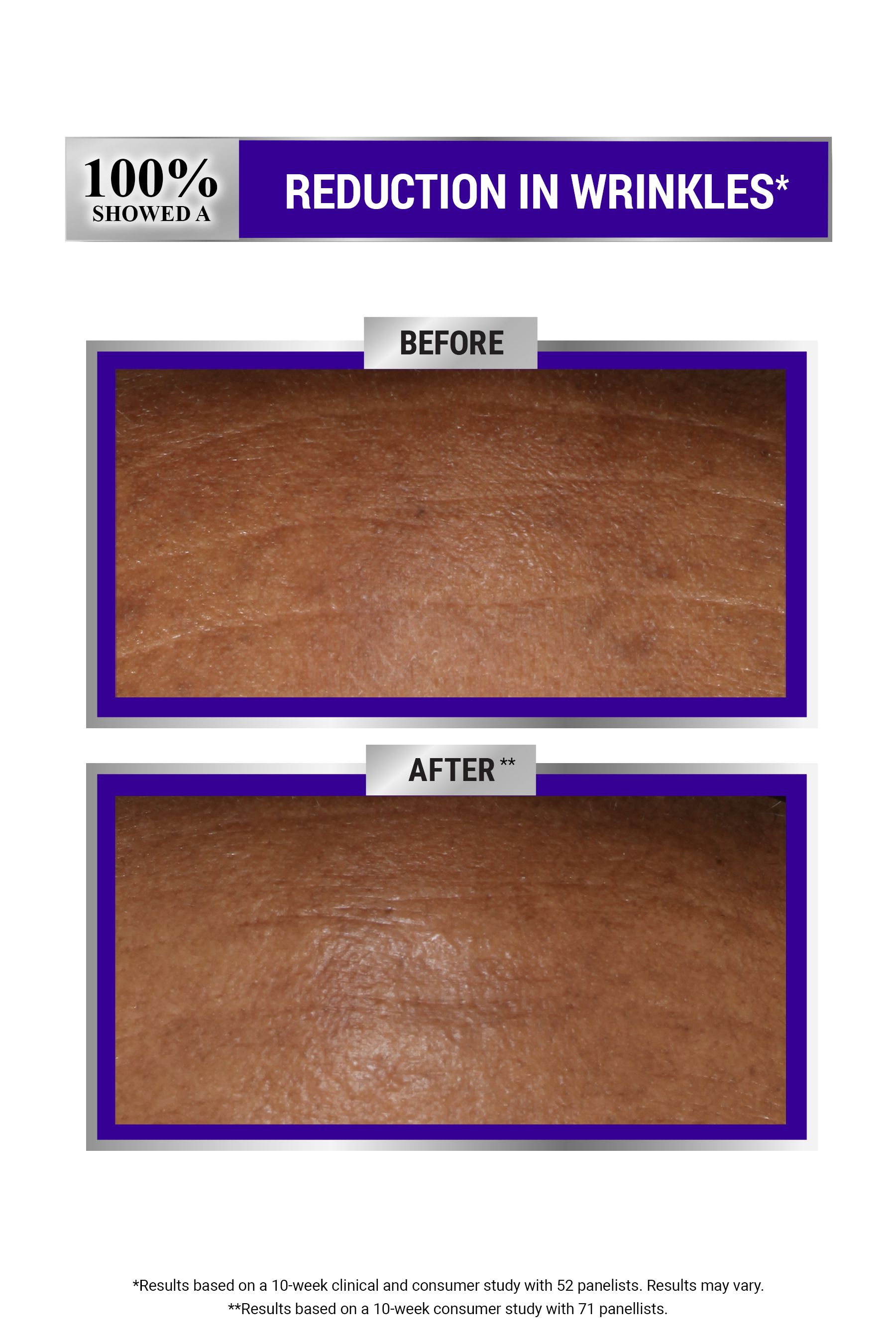 Kiehls Retinol Fast Release Wrinkle Reducing Night Serum 28ml